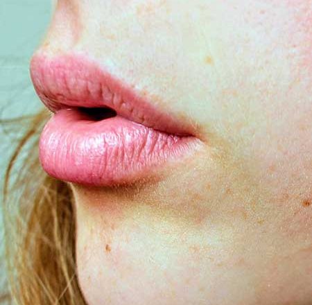 Dermatology Scribes | Medical Scribes for Dermatologists - ScribeAmerica